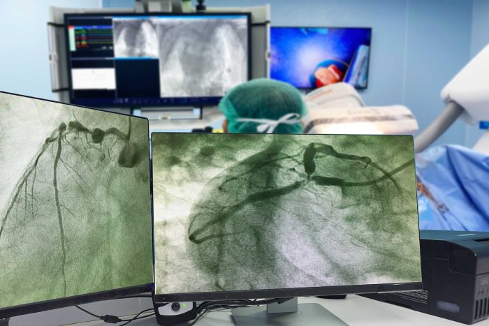 Compartimentul de Cardiologie Intervențională : Centrul Inimii Rocordis